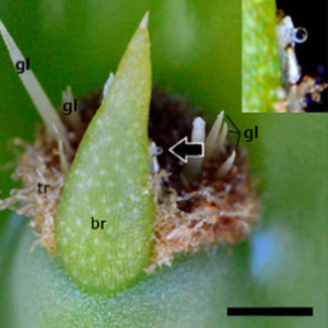 Light microscopy protocol for the study of morphology of secretory spines