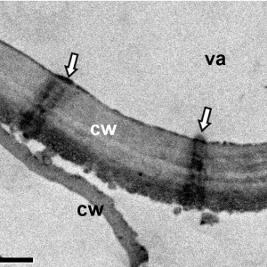 Transmission Electron Microscopy (TEM) protocol for the observation of ...