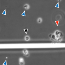 Nuclei isolation from human kidney for single-nucleus RNA-seq