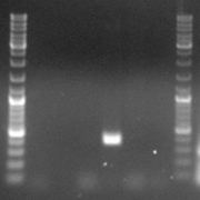 Respiratory picornavirus genotyping conventional nested RT-PCR ("Wisdom ...