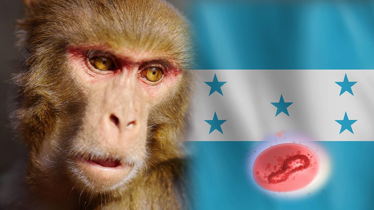Se confirma el primer caso de viruela del mono en Honduras | HRN