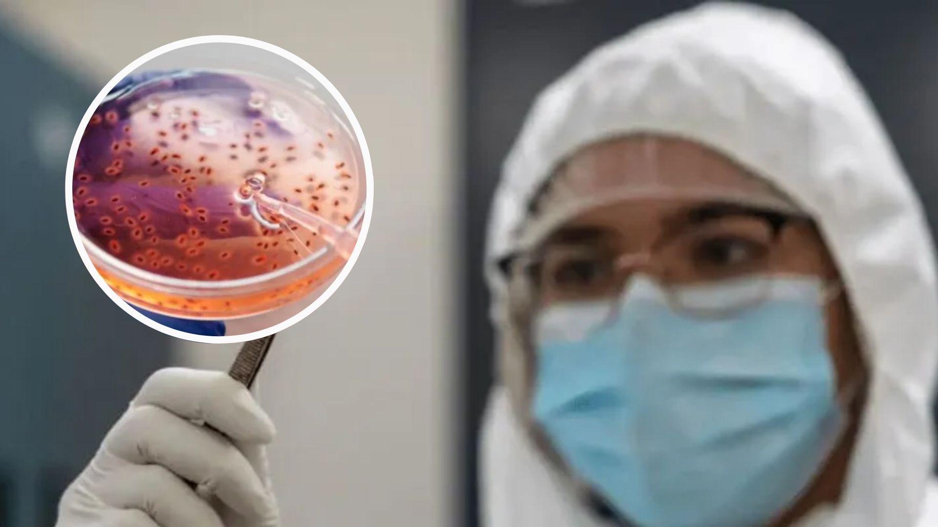 Confirman un tercer caso de peste bubónica en humanos en EE. UU. | HRN