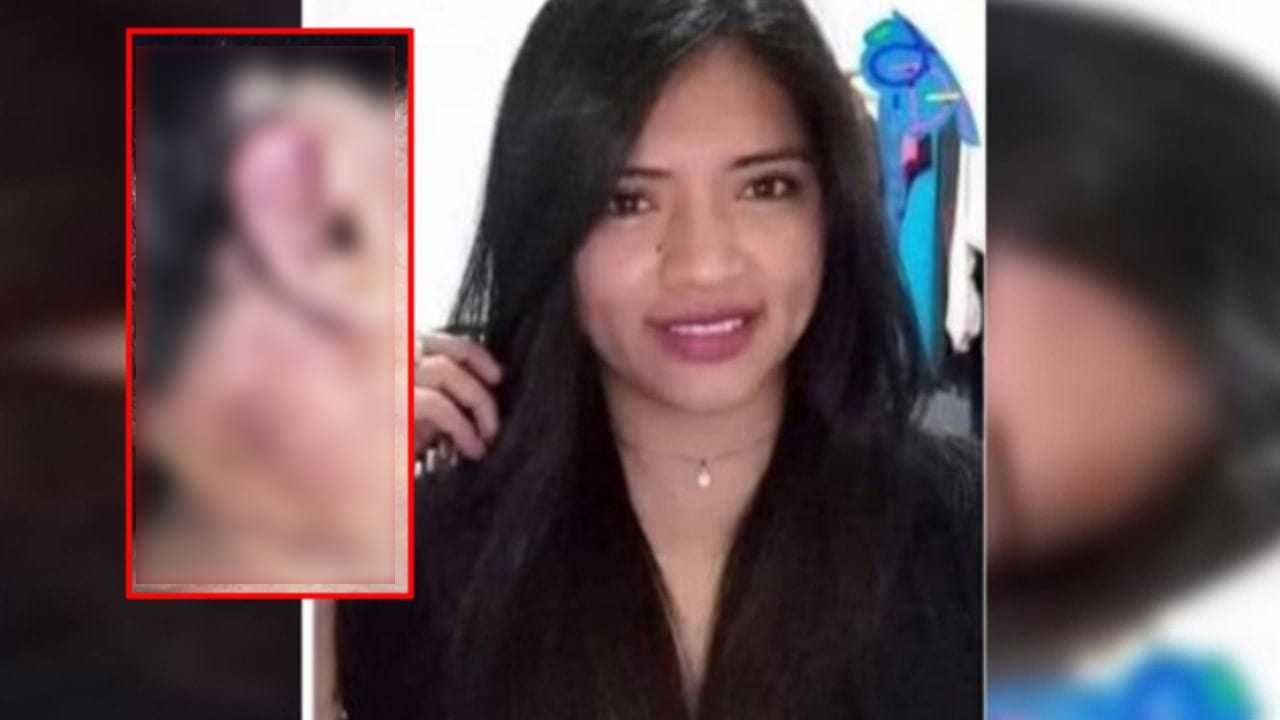 ¡Imágenes fuertes! Keyla Martínez presentó lesiones en su cuello, según ...