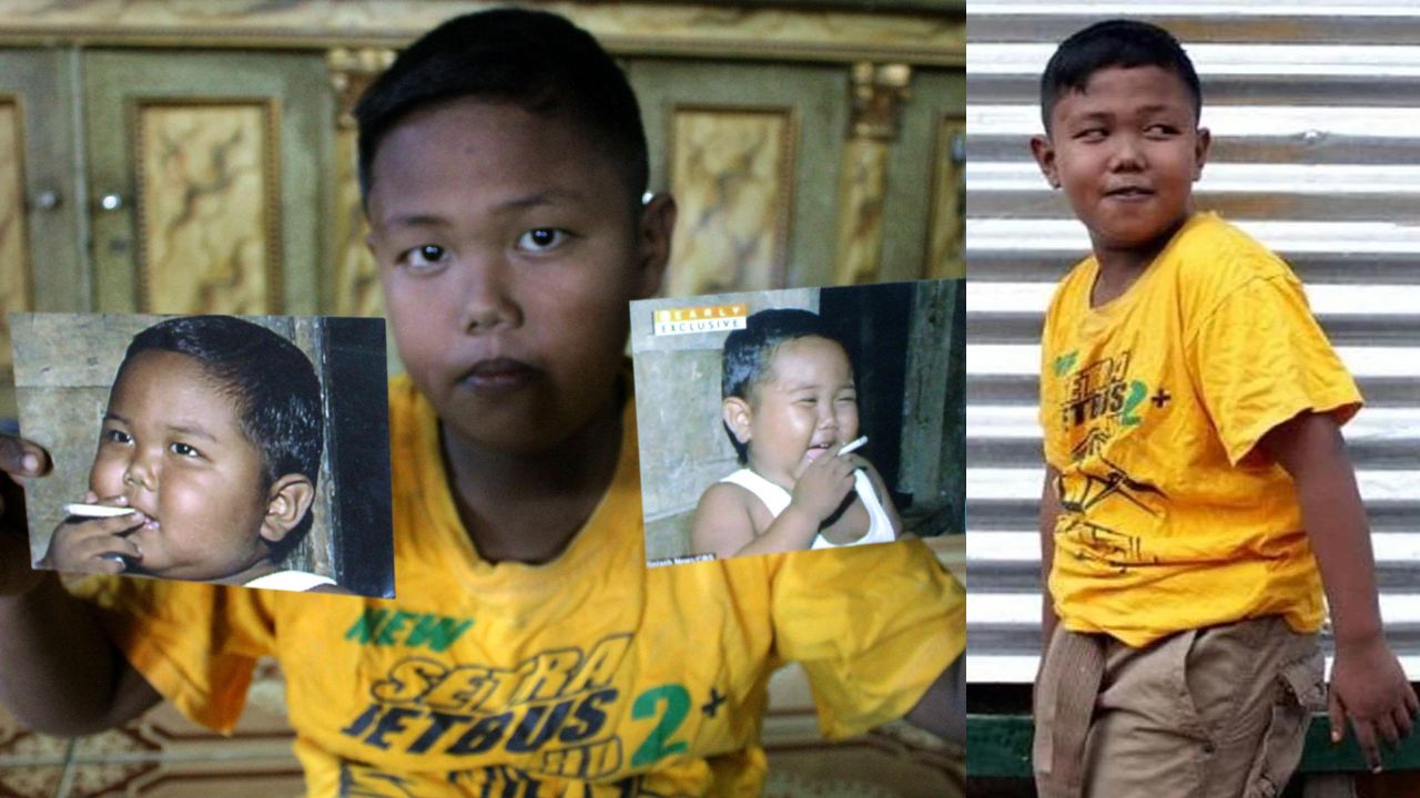 Así luce Aldi Rizal, el bebé que fumaba 40 cigarros al día