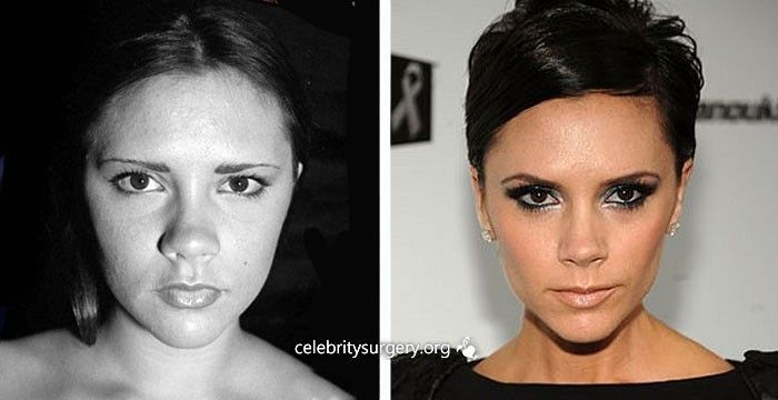 ¿Cirugía o maquillaje? Victoria Beckham y la transformación de su nariz ...