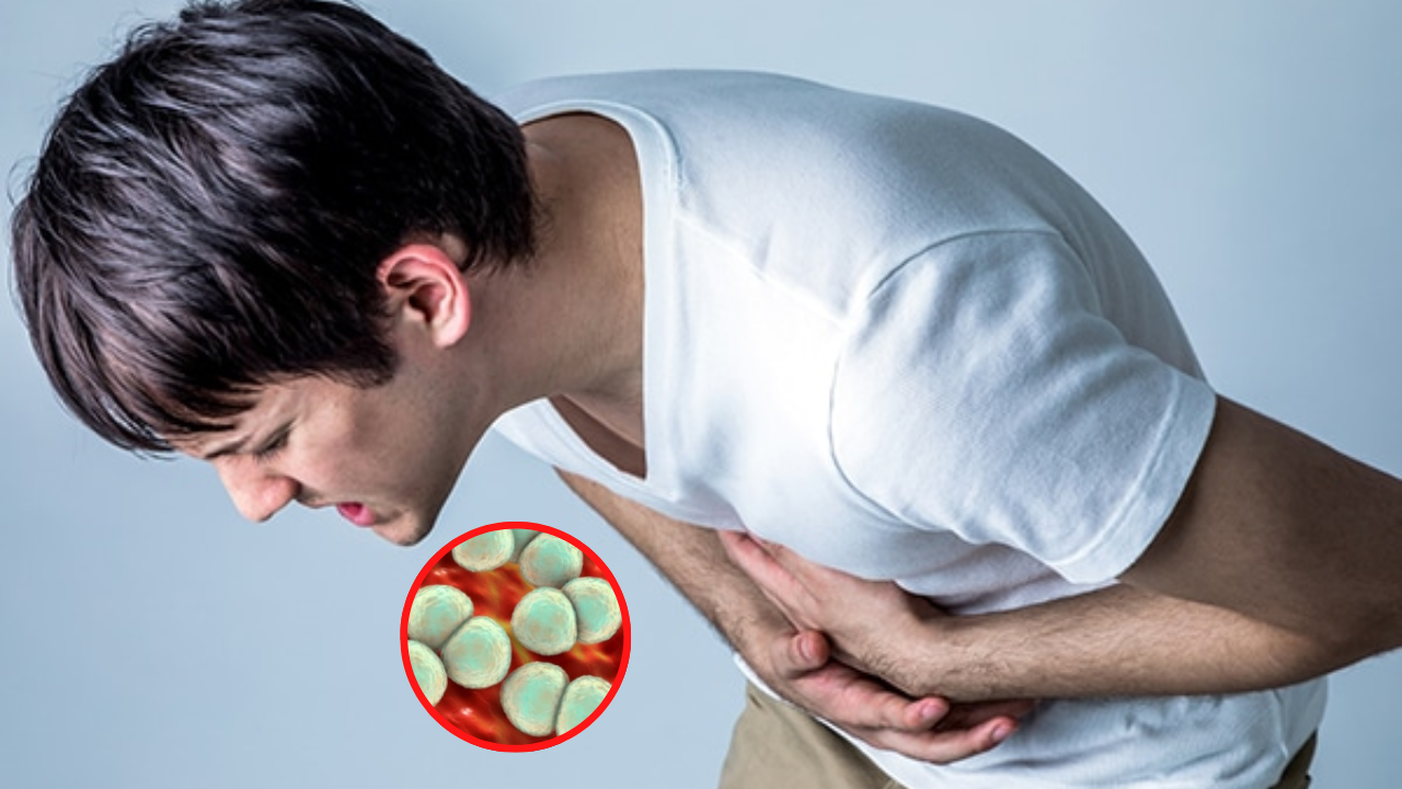 Peritonitis síntomas, ¿cómo se detecta y cuál es el tratamiento para ...