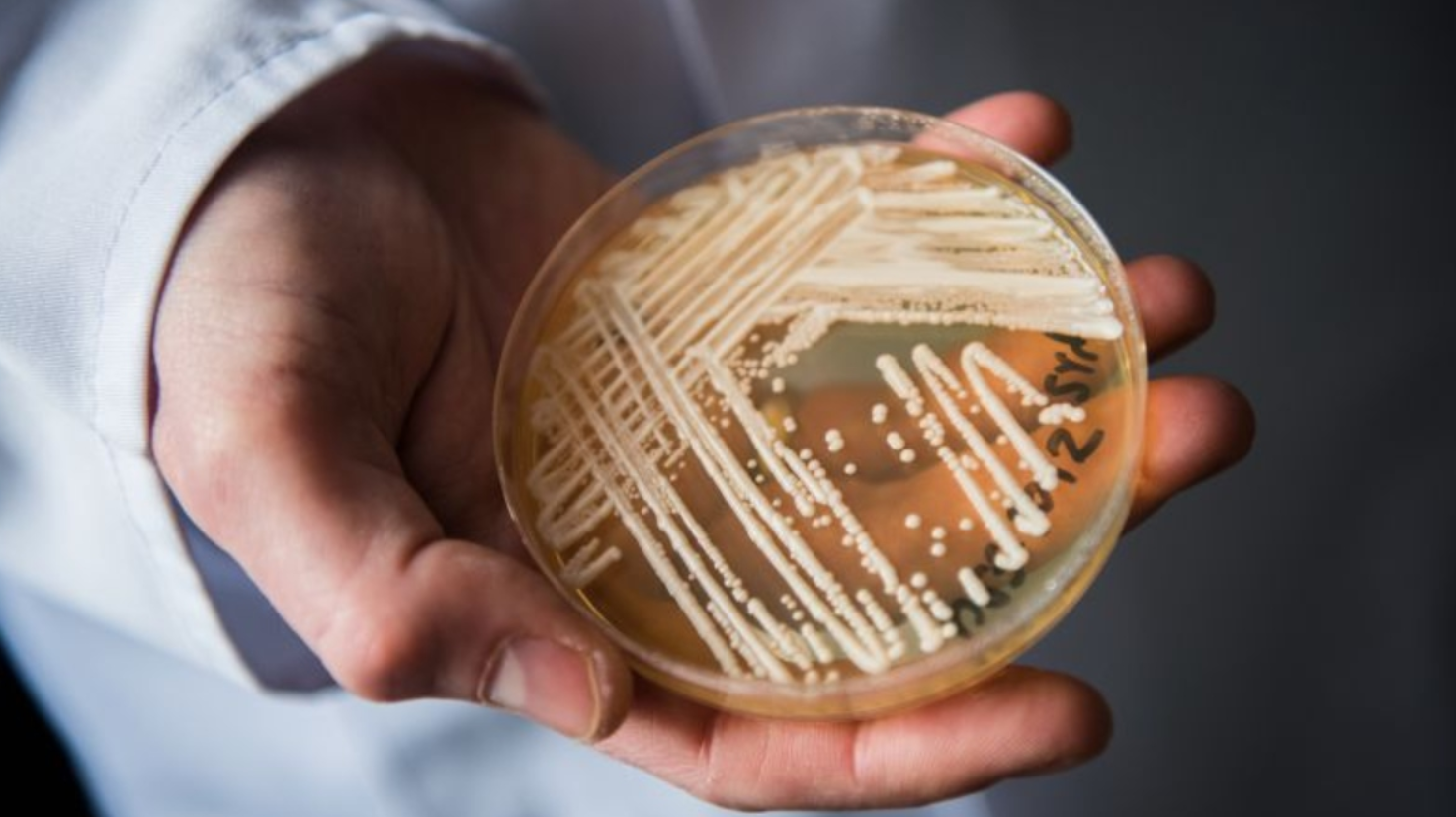 ¿Qué es el hongo Candida auris? La enfermedad que la CDC denomina como ...