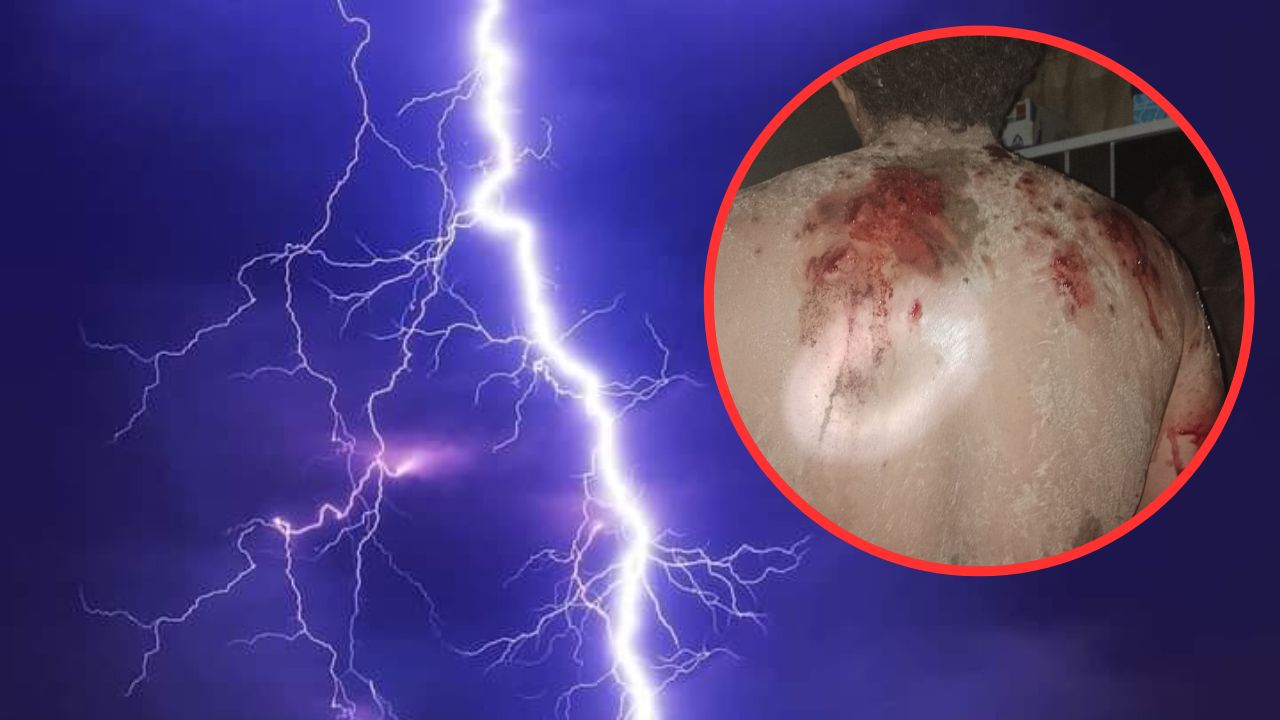 Hombre sufre impacto de rayo mientras utilizaba su celular