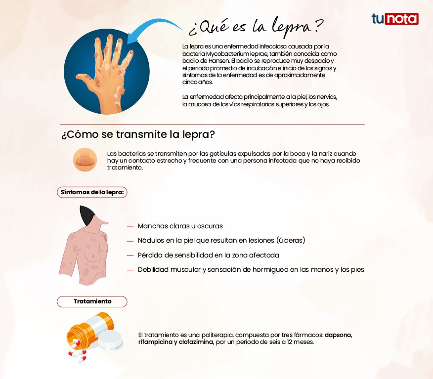 Detectan 16 casos de lepra en Choluteca