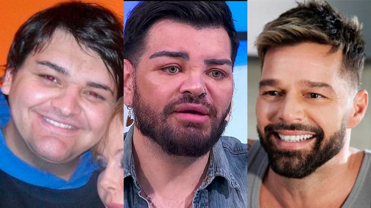 Se Operó Más De 30 Veces Para Parecerse A Ricky Martin Los Resultados