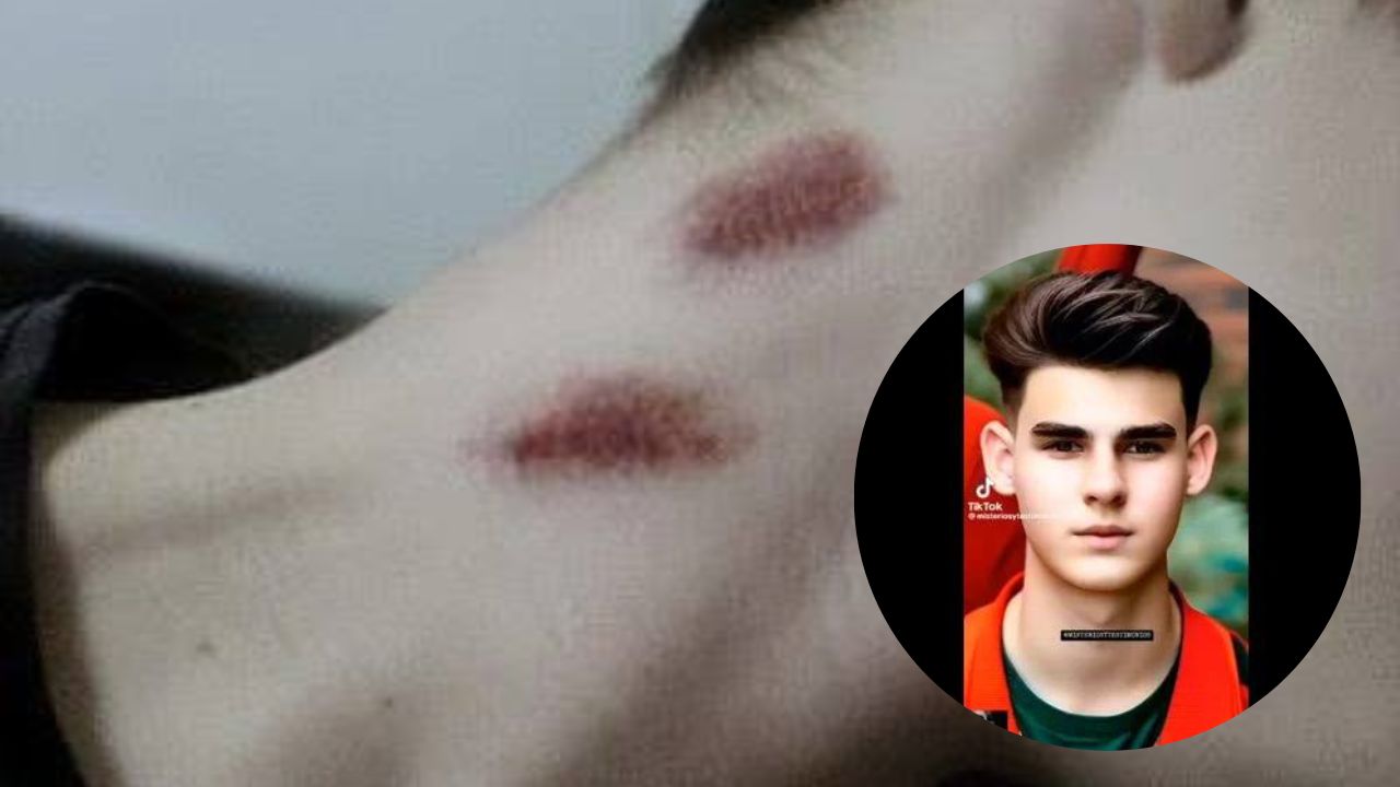 Conoce el caso de Julio Macías, joven que murió por un chupetón