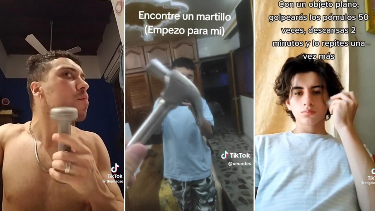 'Bone smashing': el peligroso reto viral de TikTok que pone en riesgo ...