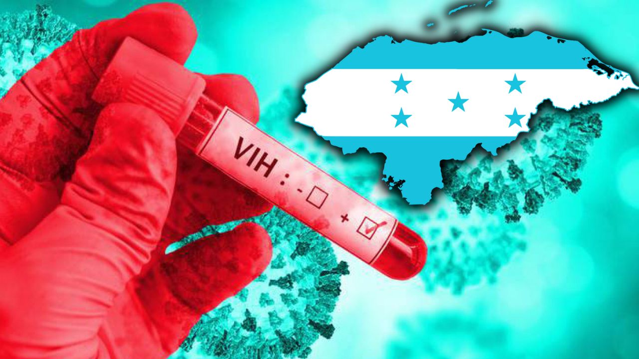 Honduras promedia entre 1,000 a 1,200 infecciones de VIH por año