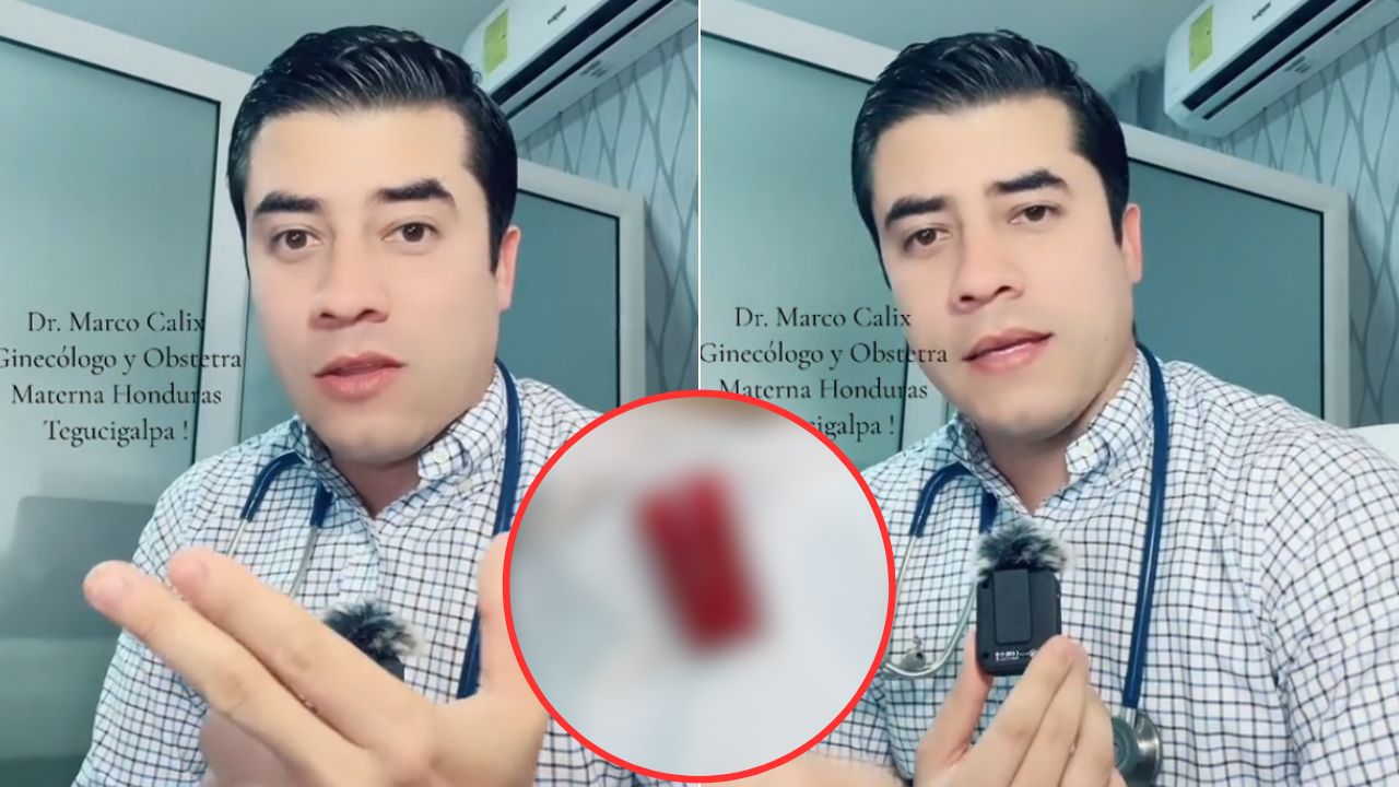 ¡Cuidado! Ginecólogo revela qué encontró en paciente problemas mentales