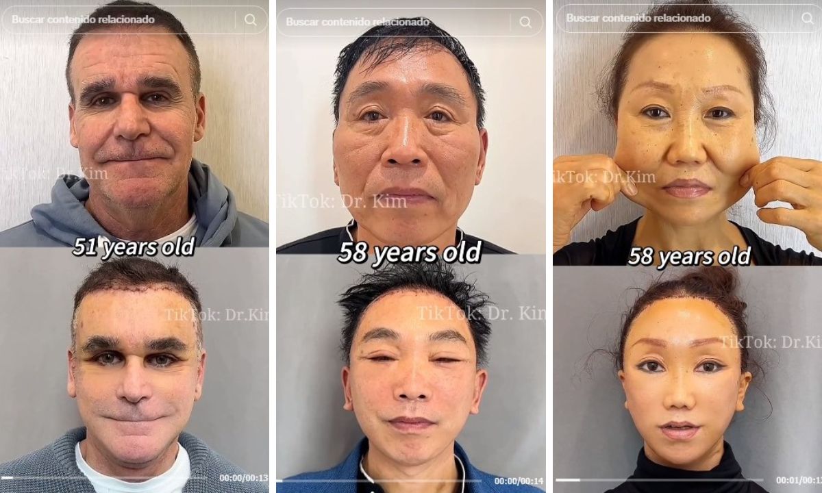 Otro cirujano turco que hace MILAGROS :roto2: - Página 2 - Forocoches