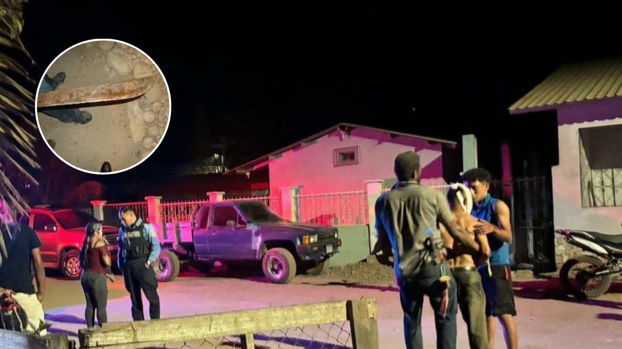 Tío Y Sobrino Se Enfrentan A Machetazos En Olancho Durante El Sábado