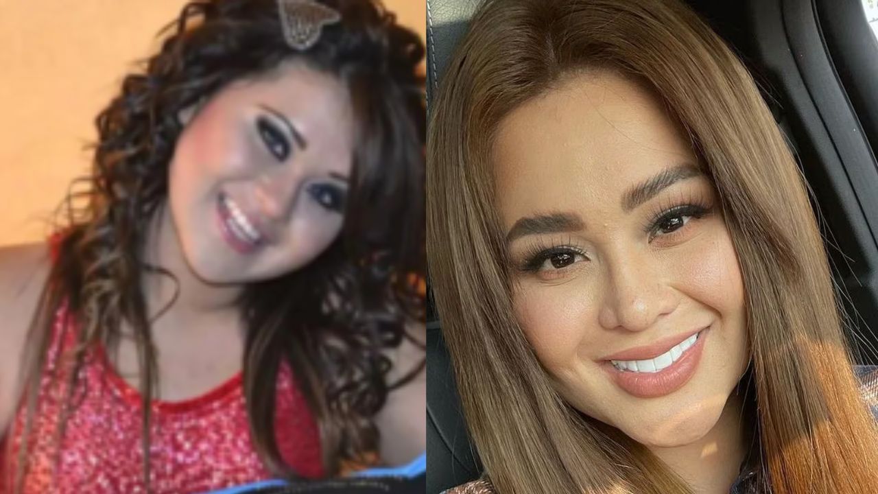 'Gomita' antes y después de las cirugías: ¿Cuáles son las operaciones ...