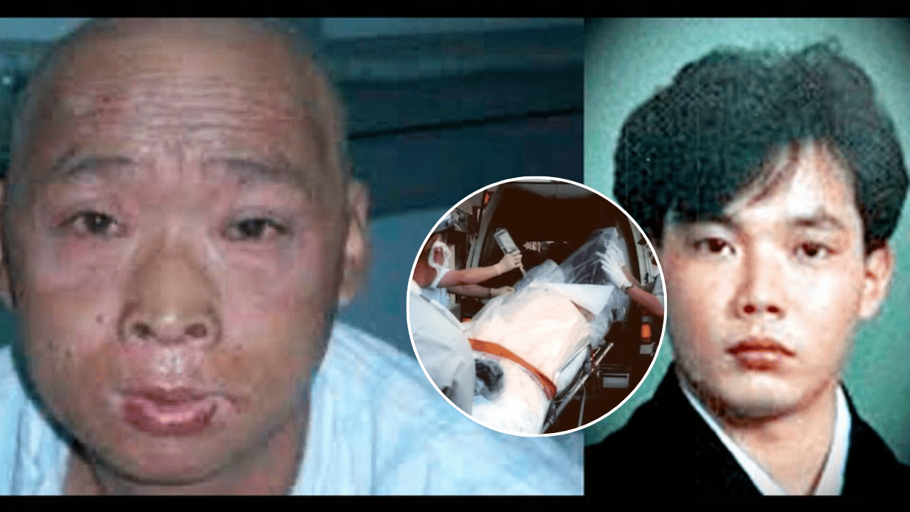 Hisashi Ouchi fotos reales: Circulan de nuevo las imágenes del trágico ...