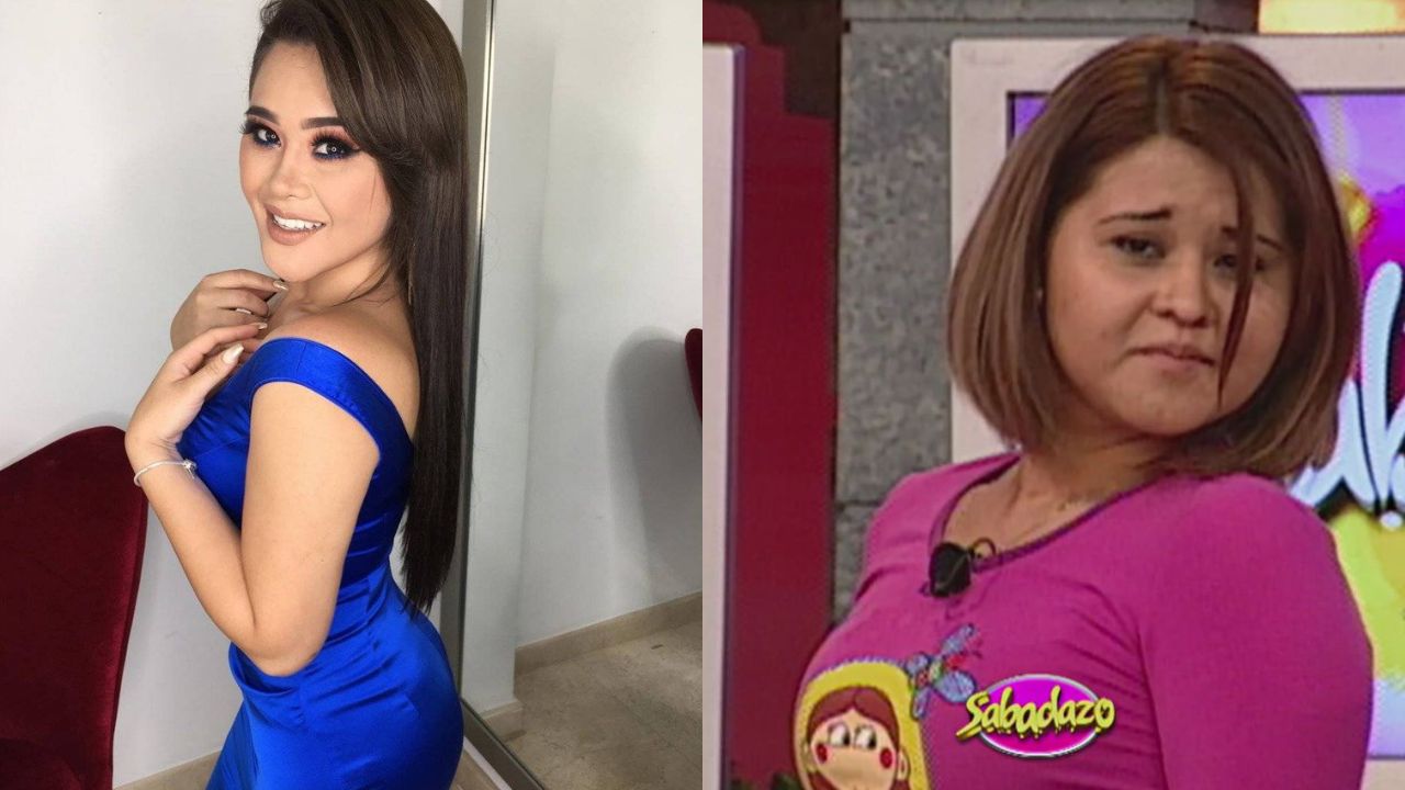 ¿Por qué le dicen Gomita?: nombre real, cirugías y edad