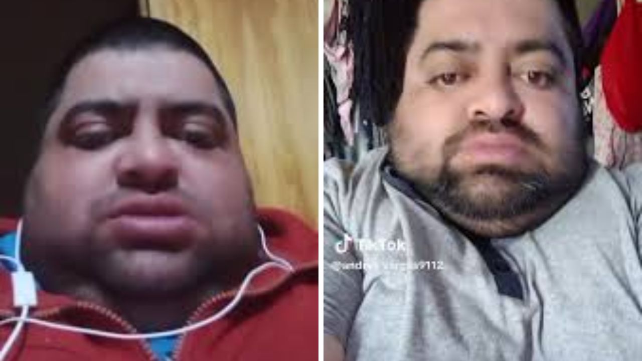 Muere Albert Andrés Vargas: ¿de qué murió el creador de contenido?