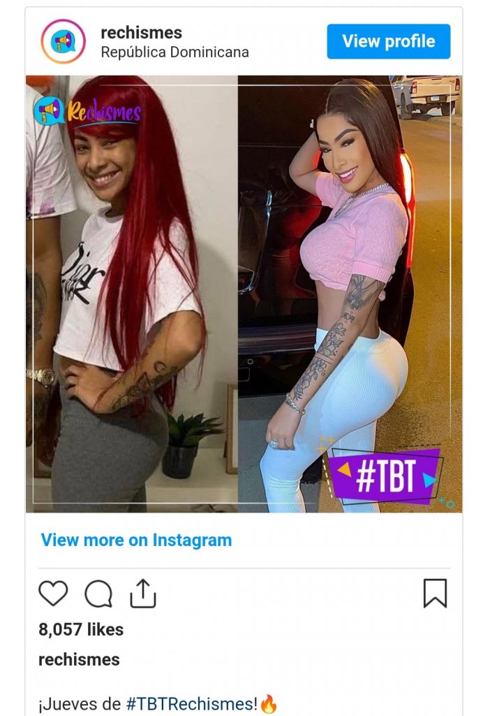 Antes y después de las cirugías de Yailin La Más Viral, nominada a los ...