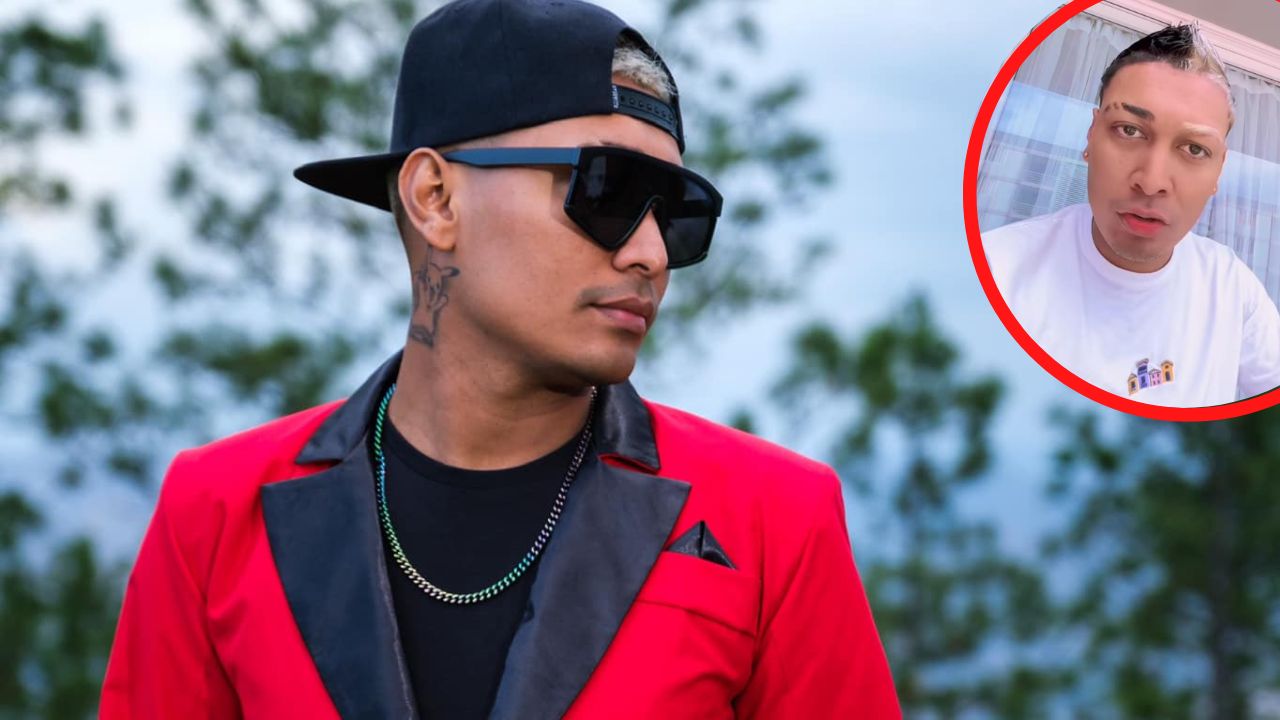 'Como dálmata': así luce Supremo con su cambio de look