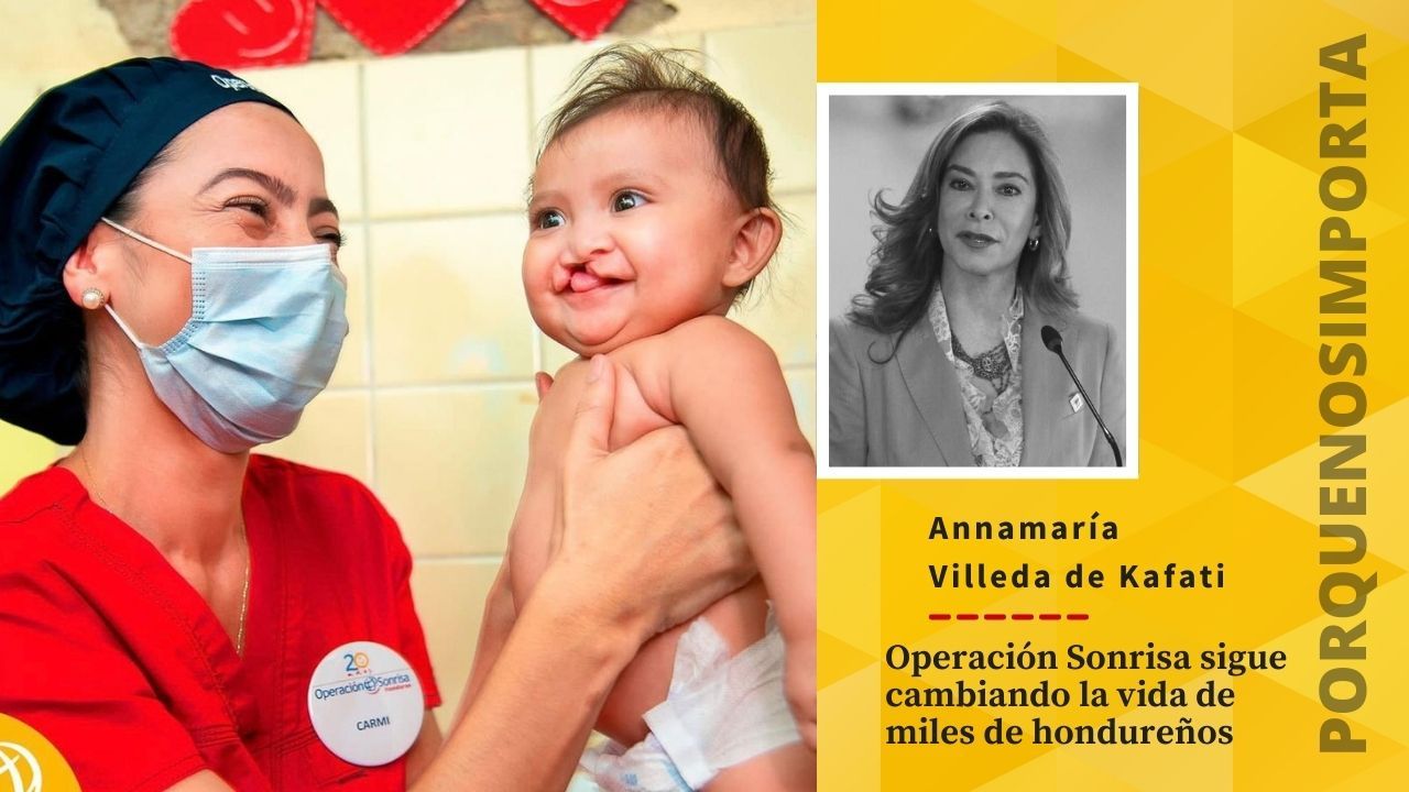 Porque Nos Importa: Operación Sonrisa sigue cambiando la vida de miles ...