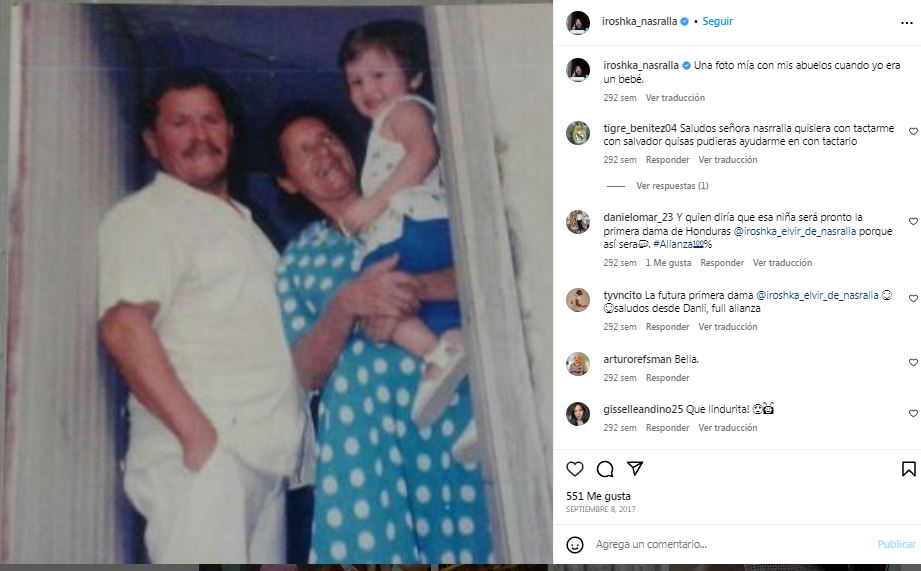 ¡Antes y después! El sorprendente cambio físico de la diputada Iroshka ...