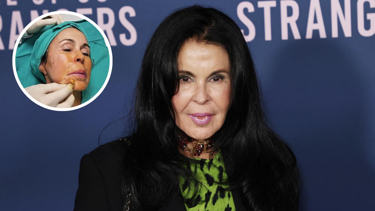 María Conchita Alonso revela los motivos de su reciente cirugía