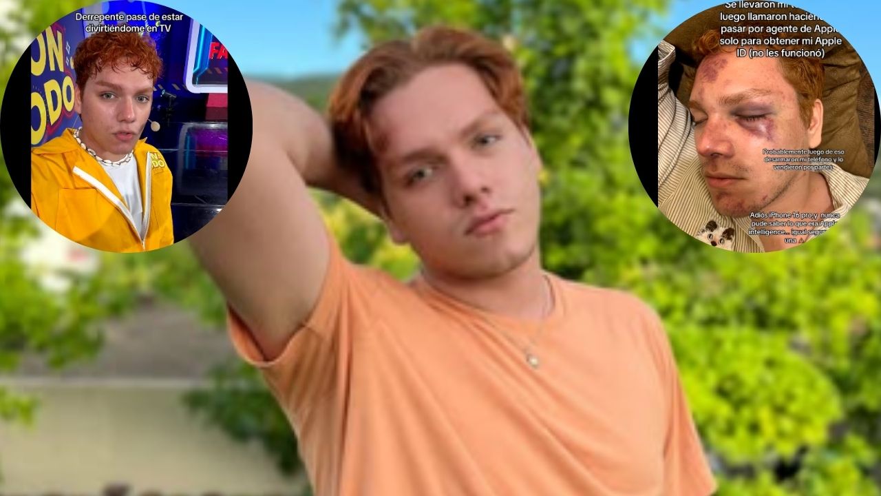 Influencer hondureño Patrick Nelson denuncia brutal agresión y despido tras ataque