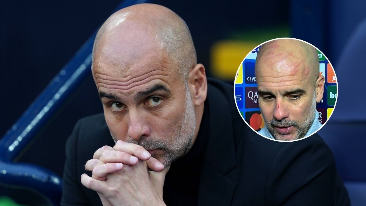 Pep Guardiola sorprende con heridas en su rostro ¿Qué le pasó al ...
