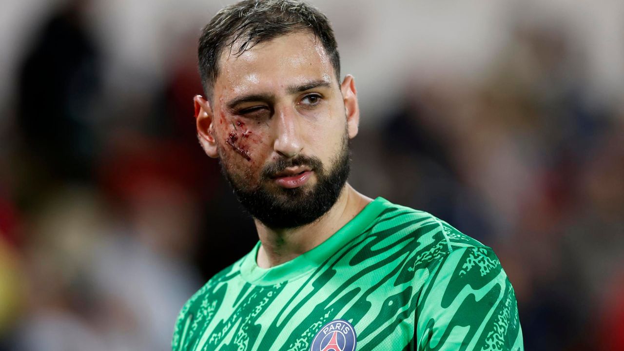 Gianluigi Donnarumma sufre terrible lesión que le provocó heridas en su ...