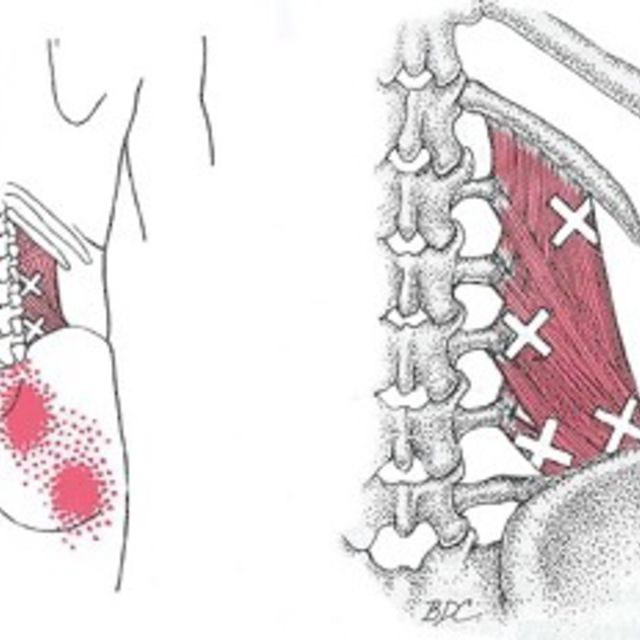 Quadratus Lumborum - Exercise How-to - Workout Trainer by Skimble
