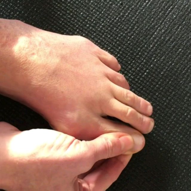 Toe Abduction & Adduction - Exercise How-to - Workout Trainer by Skimble