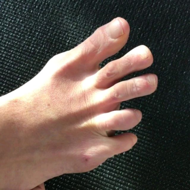 Toe Abduction & Adduction - Exercise How-to - Workout Trainer by Skimble