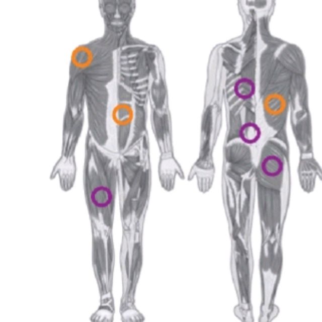 Standing Roll Out TRX - Exercise How-to - Skimble