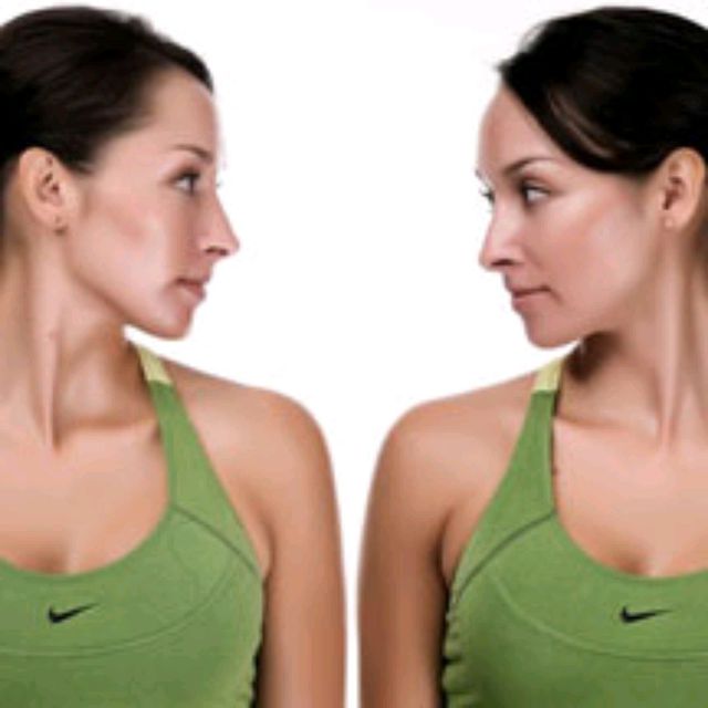 Neck Rotation - Exercise How-to - Workout Trainer by Skimble