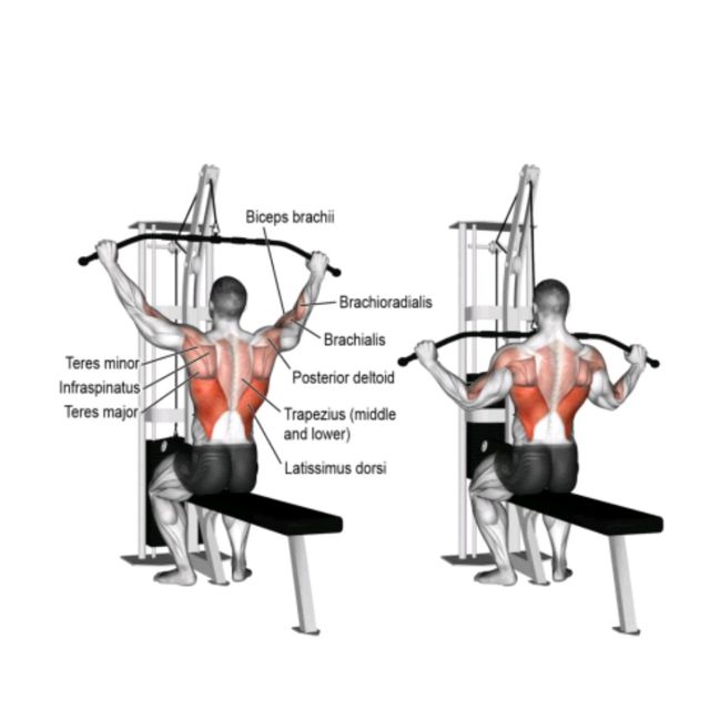 Lat Machine by Antonio Carola - Exercise How-to - Skimble