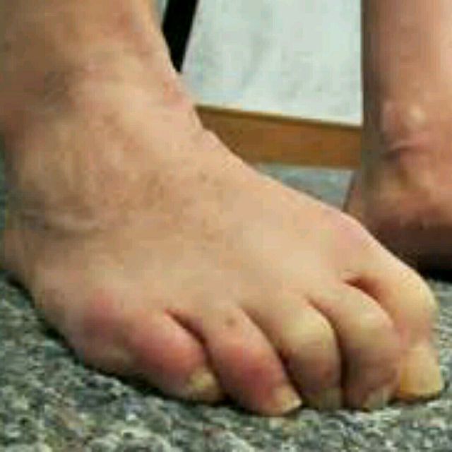 Toe Curls por Silas Eisenback - Ejercicio Cómo hacerlo - Skimble