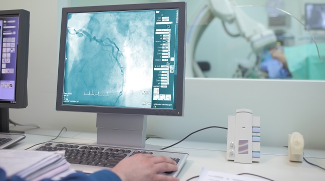 Incomplete Revascularization Linked With Increased MACE in Subsequent ...