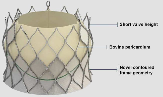 Novel Repositionable TAVR Device Sees Low Pacemaker Rates and Few Leaks ...