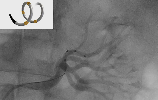 Prominent Investigator Takes Post at Medtronic as Pivotal Renal ...