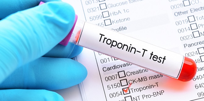 High-Sensitivity Troponin Performs Well Against Traditional Tools for ...