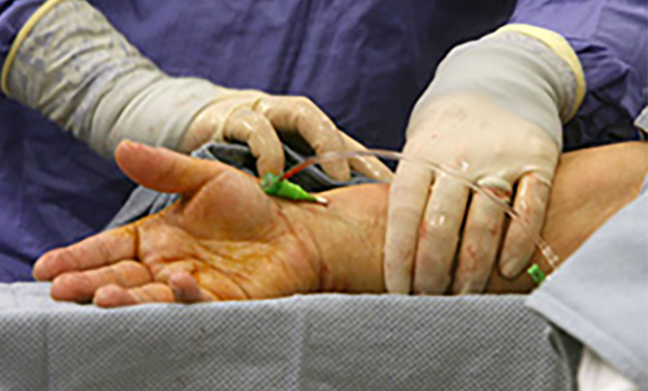 Interventionalists Push Transradial PCI in Wider Range of Settings ...