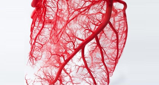 STEMI Patients With Persistent Ischemia After PCI: A Potential Target ...