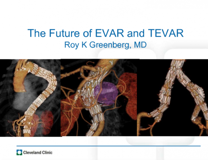 EVAR and TEVAR: Future Directions | tctmd.com