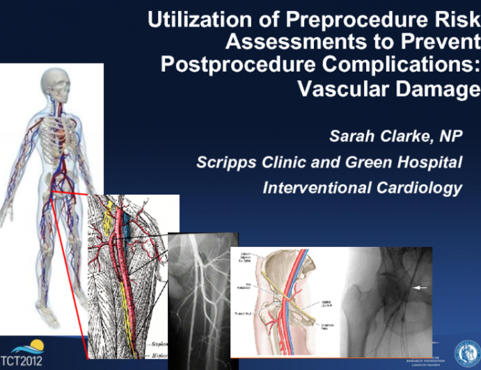 Vascular Damage | tctmd.com