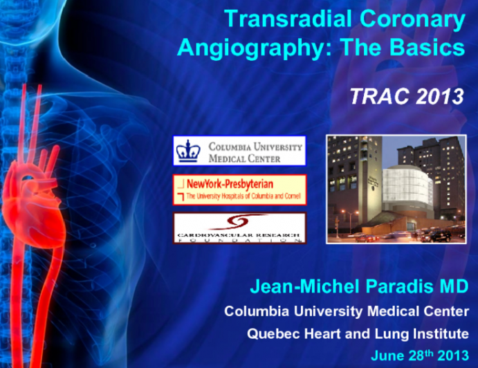 Transradial Coronary Angiography: The Basics | tctmd.com