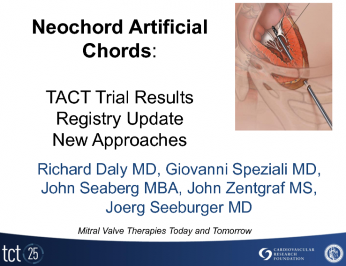 Neochord Artificial Chords | tctmd.com