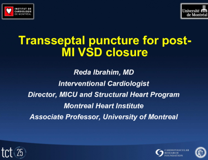 For Post-MI VSD Closure | tctmd.com